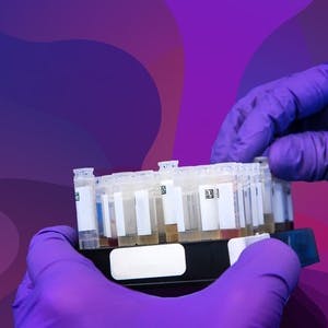 Kite acquires Interius BioTherapeutics for USD 350 million to advance ...